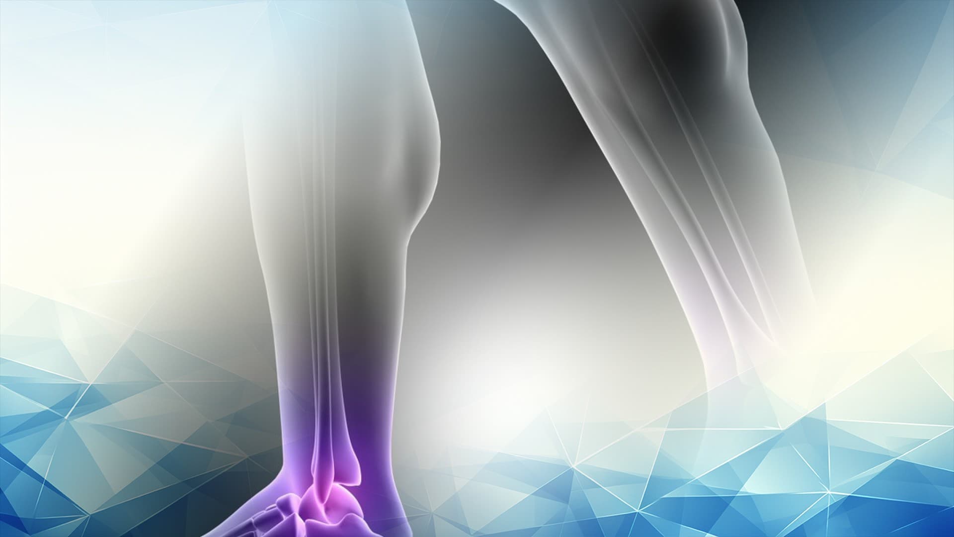 Risks and Complications of Achilles Tendon Repair Surgery | Private MSK ...