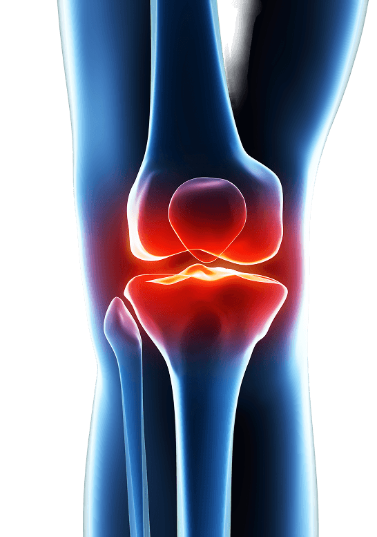 Knee Meniscus Repair | Arthroscopic Cartilage Surgery | MSK Doctors